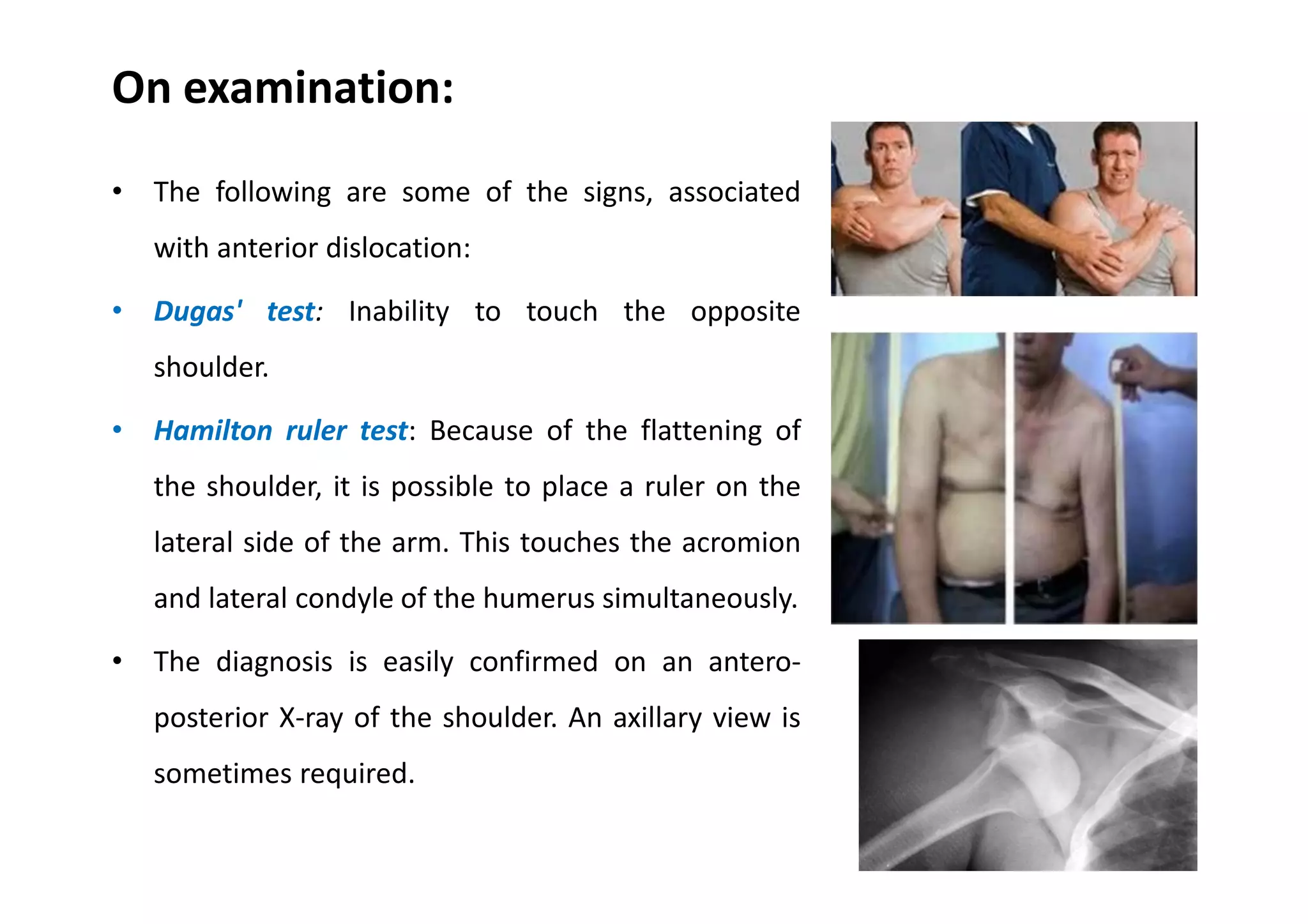 Fractures around shoulder | PDF