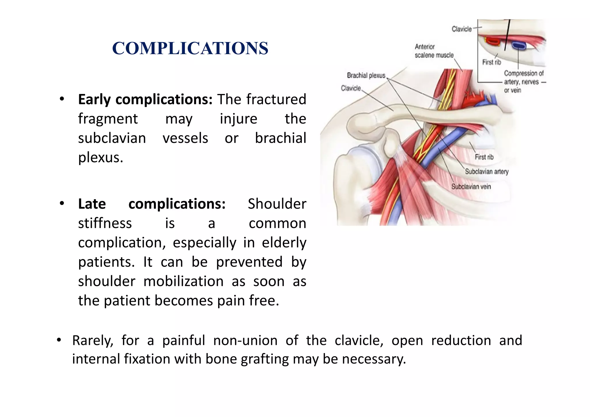 Fractures around shoulder | PDF