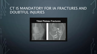 Fractures around the knee | PPTX