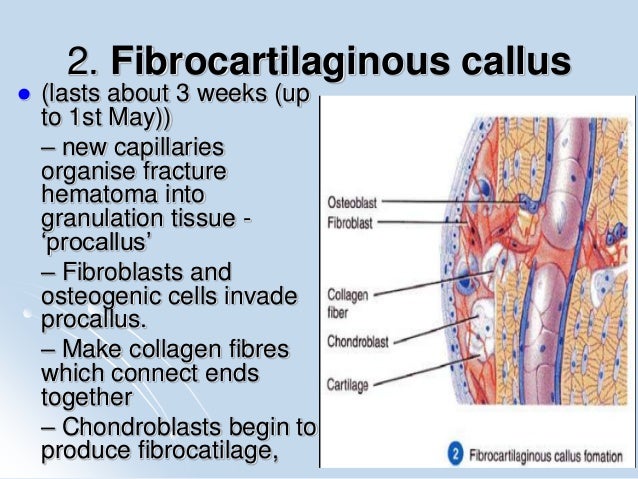 Fractures, bone healing & principles of tx. of fractures