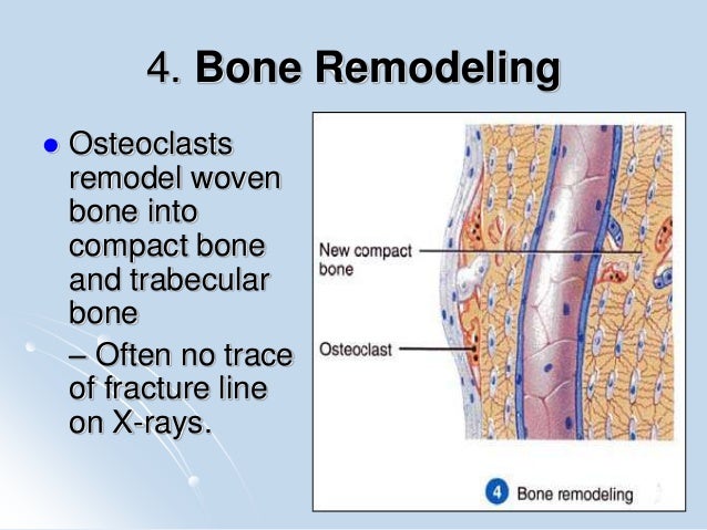 Fractures, bone healing & principles of tx. of fractures