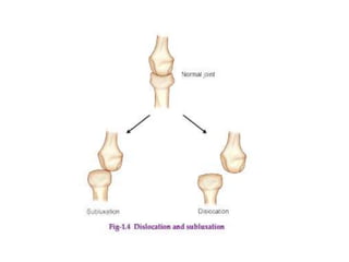 Fractures & dislocations general principles | PPTX