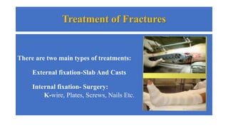 FRACTURES & DISLOCATIONS general overview.pptx