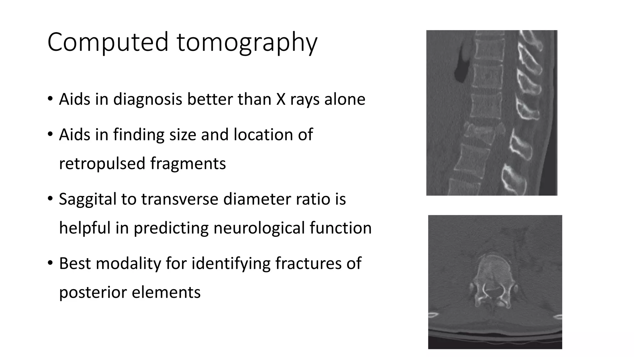 fractures & dislocation spine.pptx