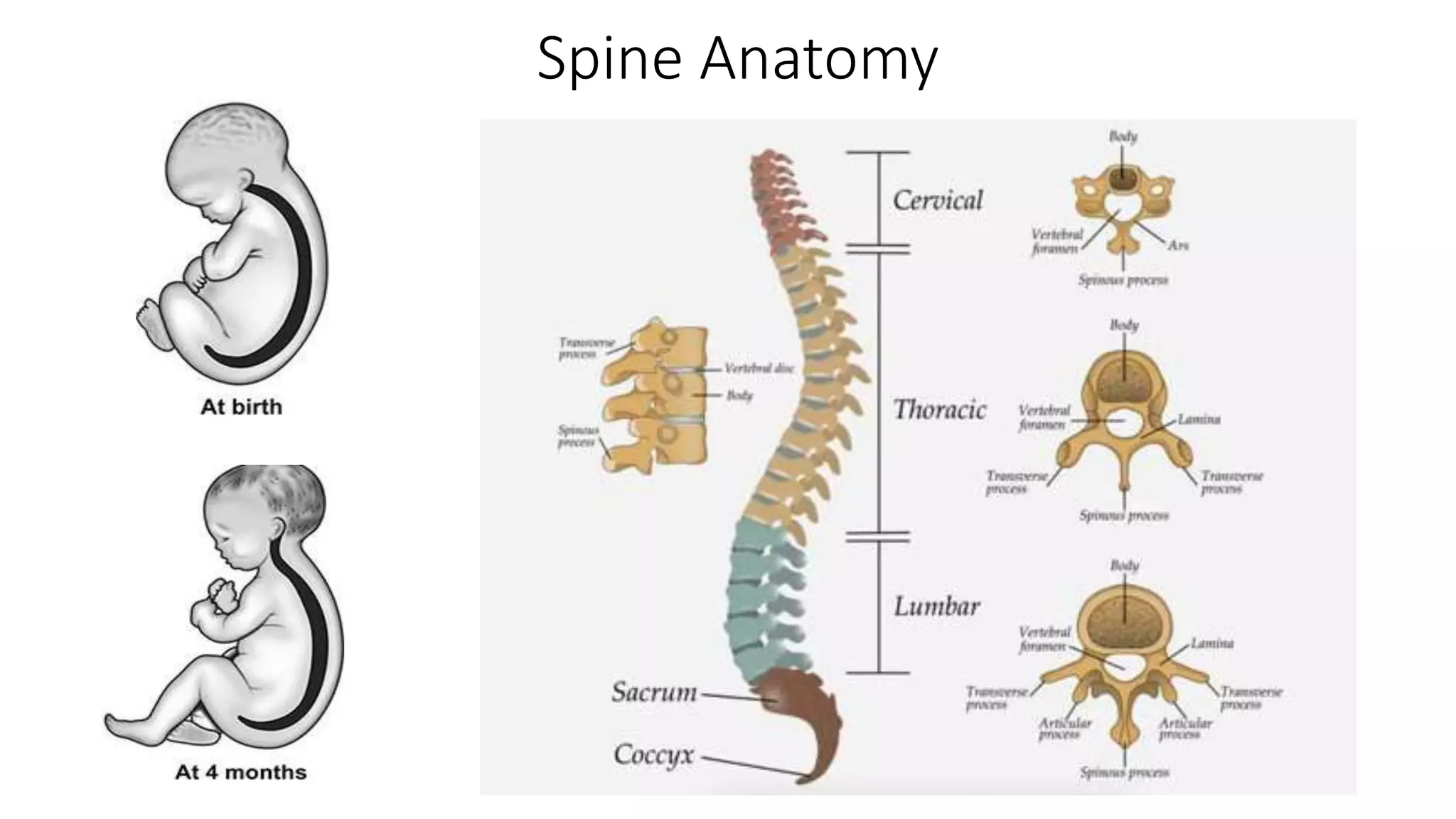 fractures & dislocation spine.pptx