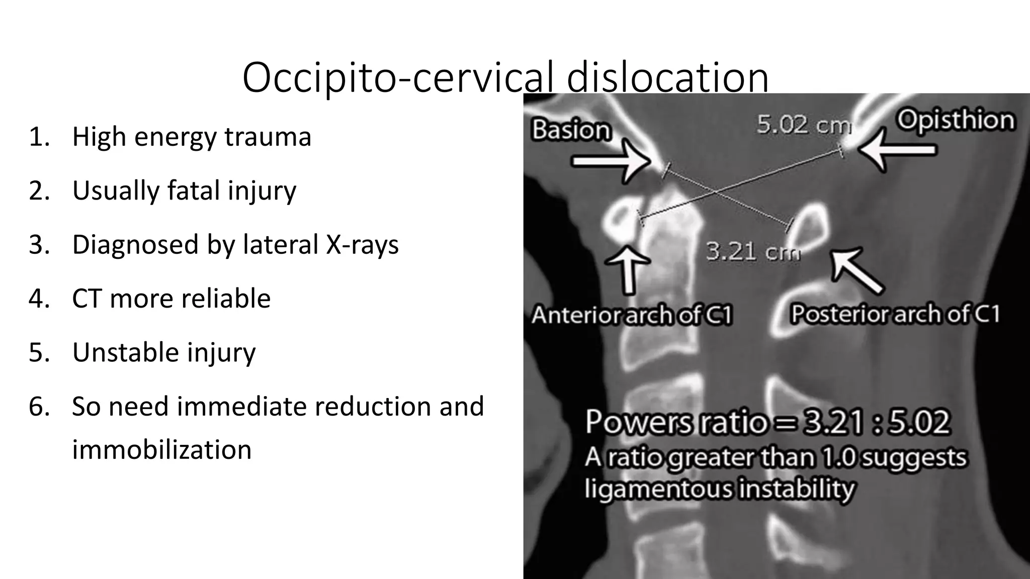 fractures & dislocation spine.pptx
