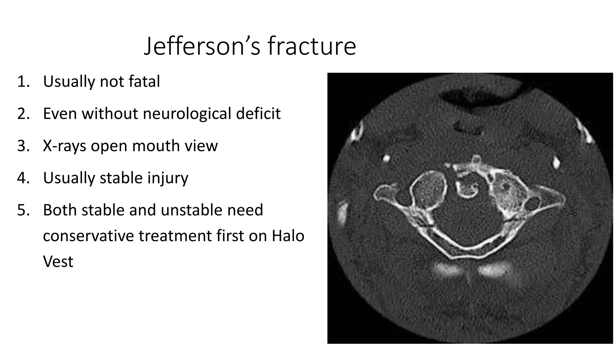 fractures & dislocation spine.pptx