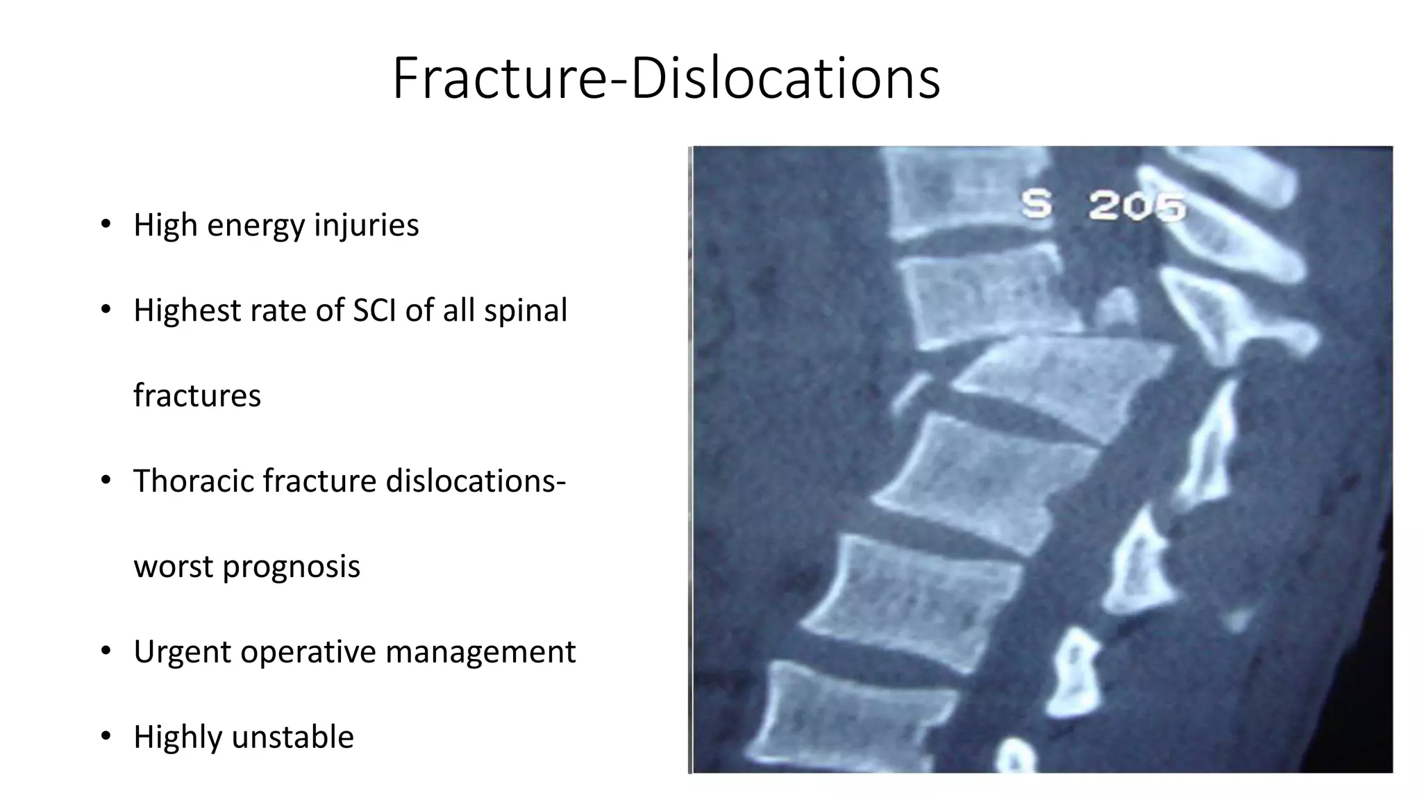 fractures & dislocation spine.pptx