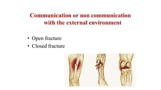 Fracture classification | PPTX