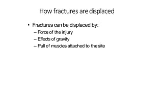 Fracture classification | PPTX