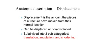 Fracture classification | PPTX