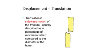 Fracture classification | PPTX