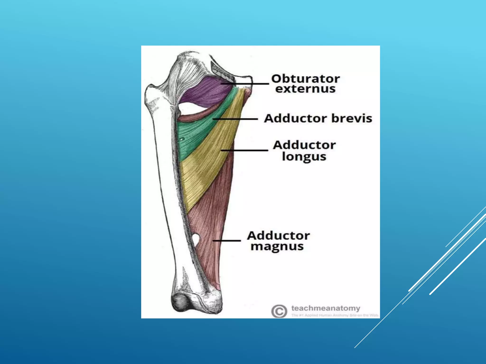 fracture shaft of femur.pptx