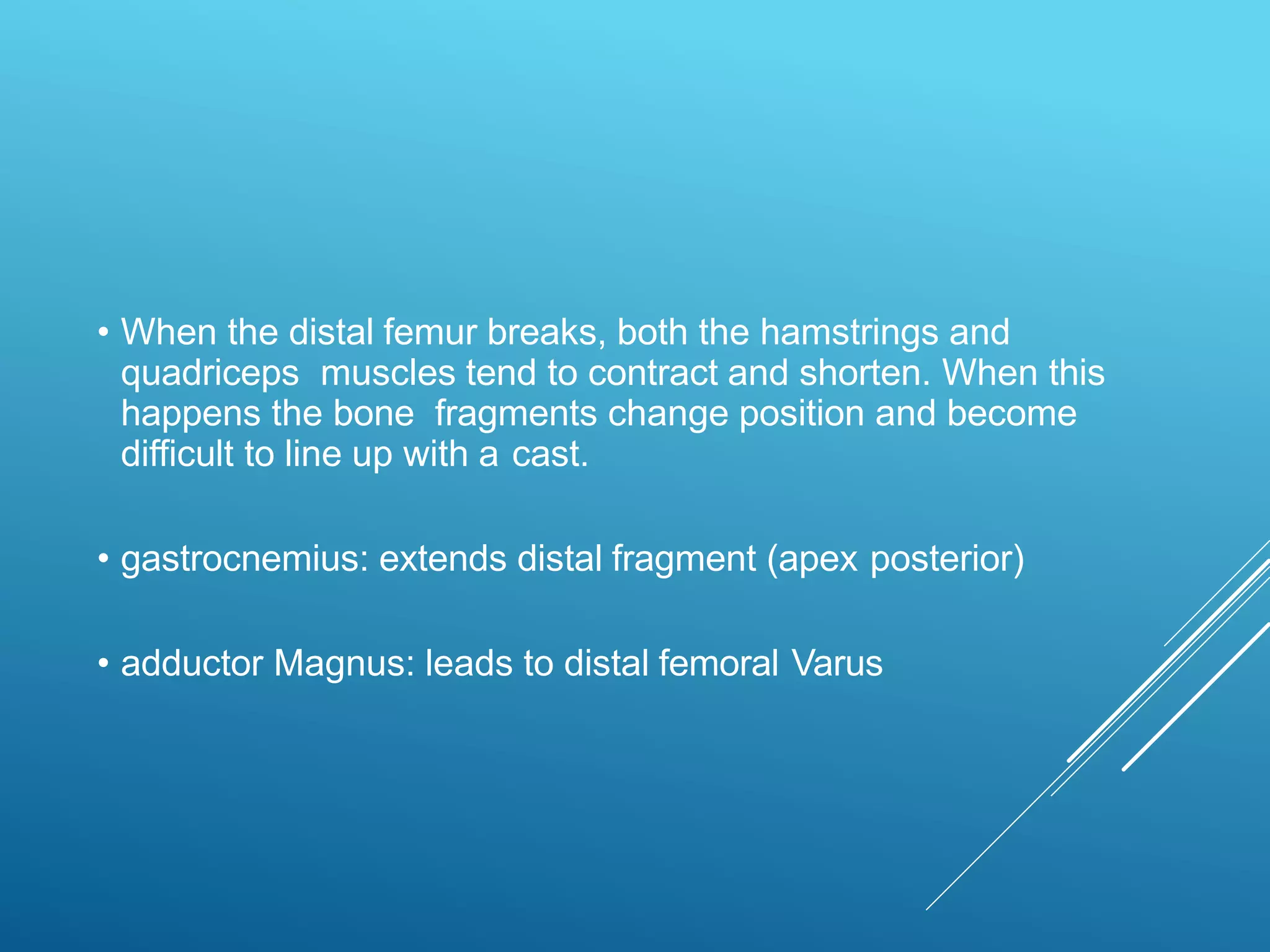 fracture shaft of femur.pptx