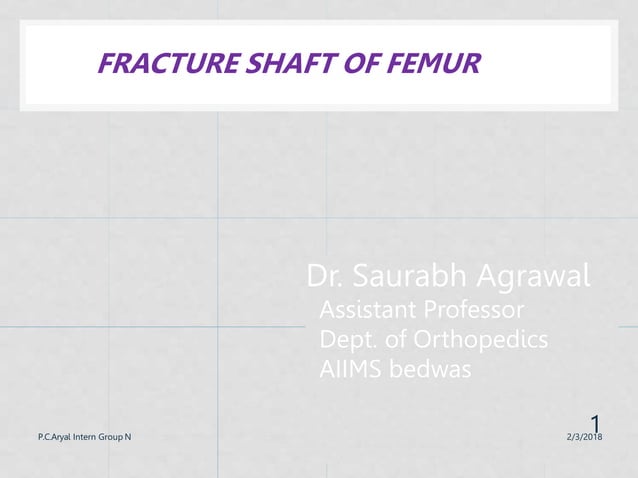 fracture shaft of femur.pptx | First Aid | Injuries