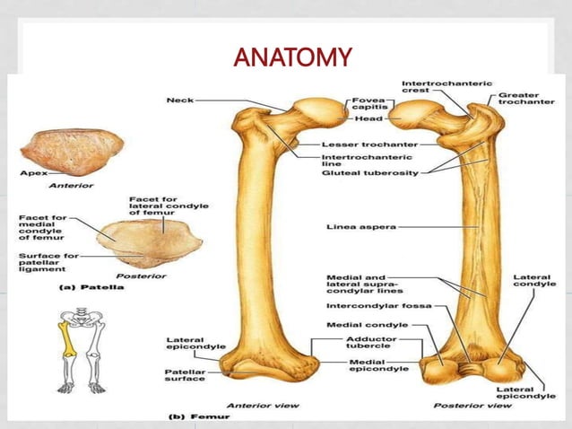 fracture shaft of femur.pptx | First Aid | Injuries