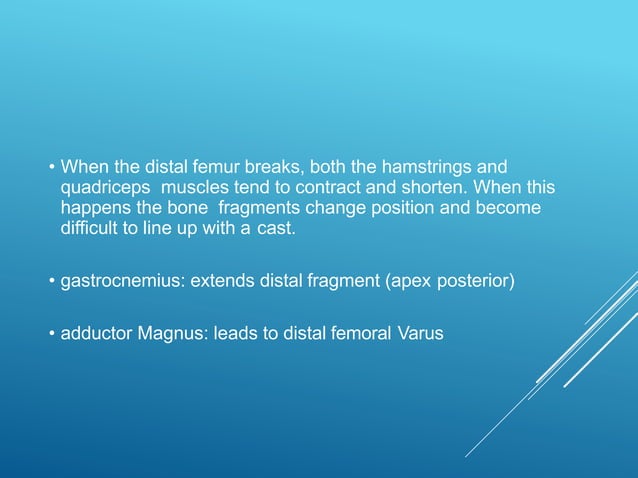 fracture shaft of femur.pptx | First Aid | Injuries