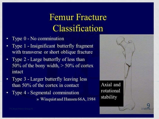 fracture shaft of femur.pptx | First Aid | Injuries