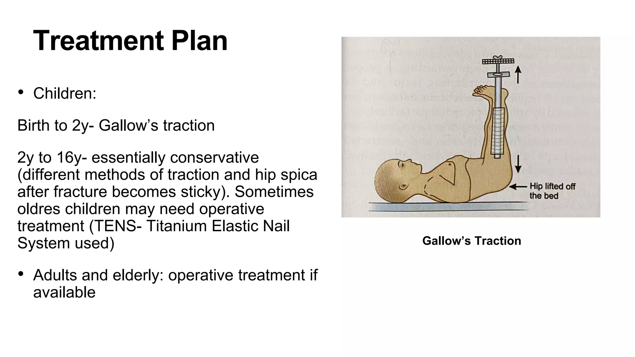 Fracture shaft of femur | PPTX