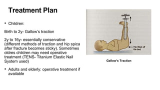 Fracture shaft of femur | PPTX