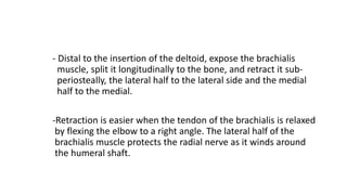Fracture shaft of humerus | PPTX
