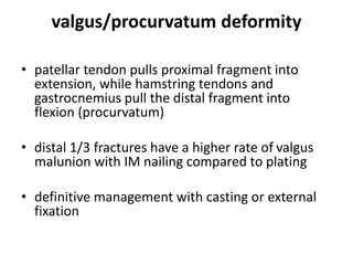 FRACTURE SHAFT OF TIBIA-1.pptx