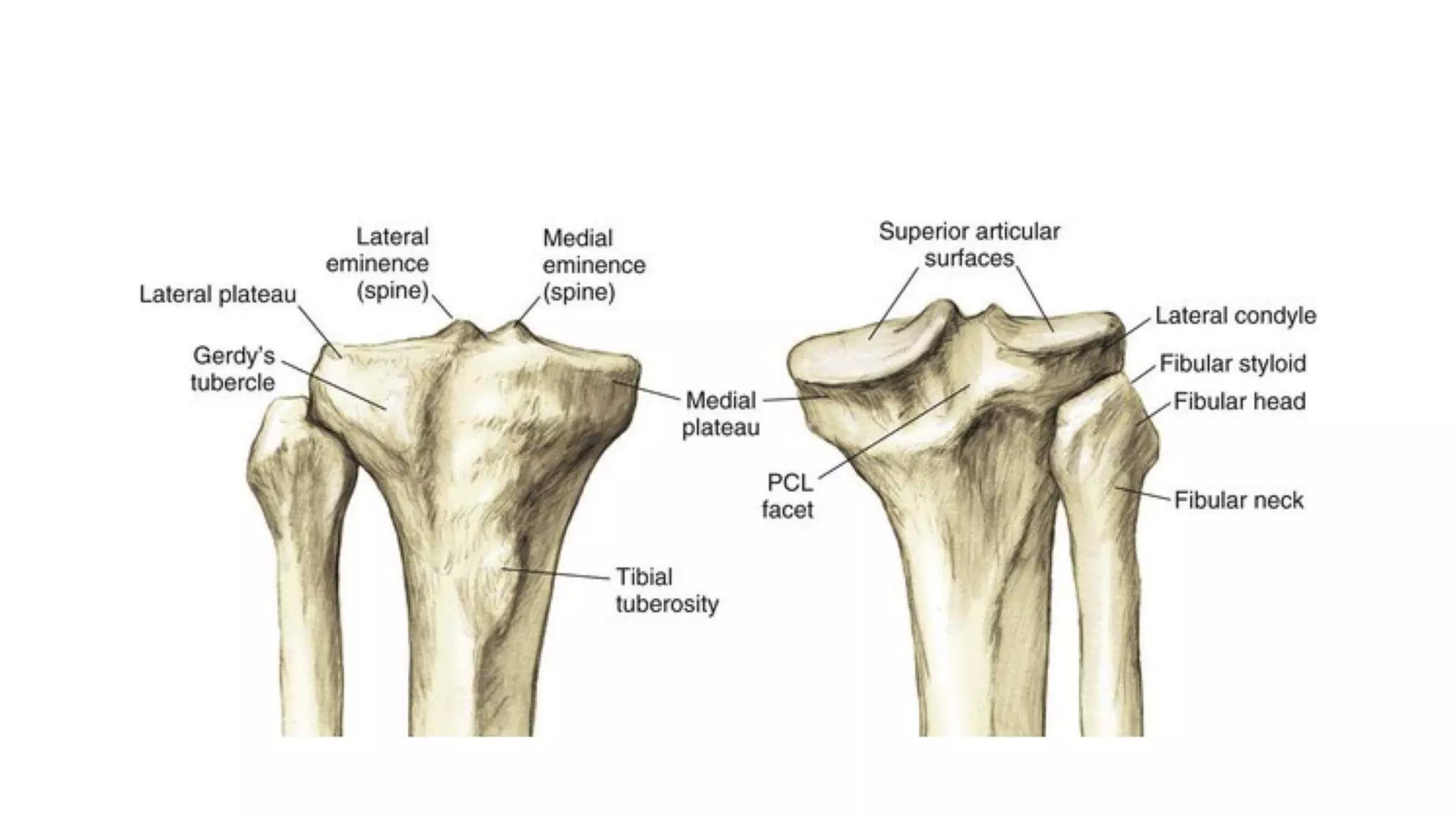 Fracture shaft of tibia | PPTX