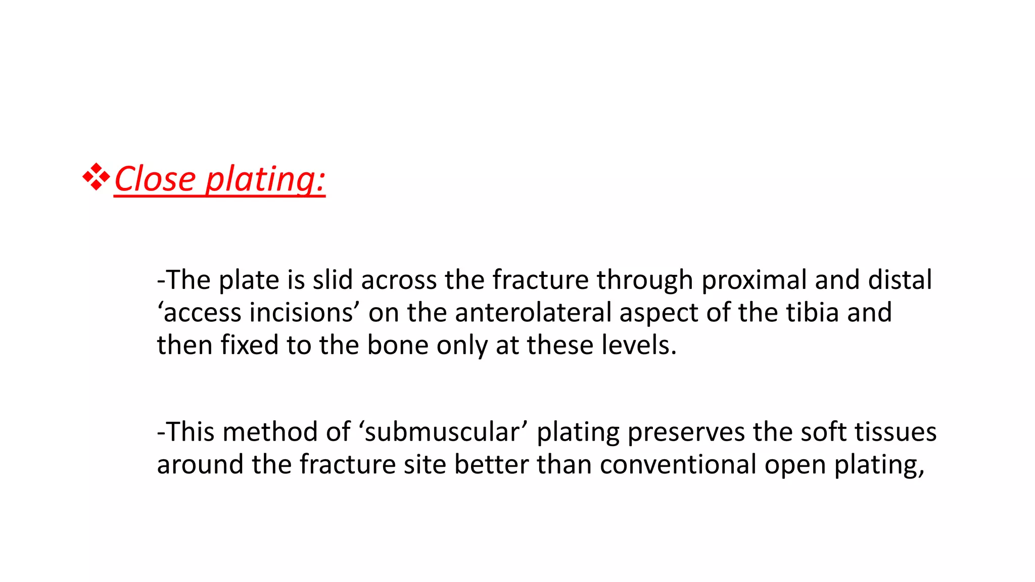 Fracture shaft of tibia | PPTX