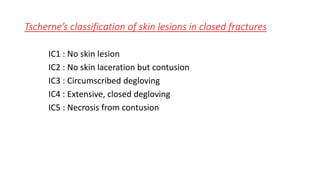 Fracture shaft of tibia | PPT