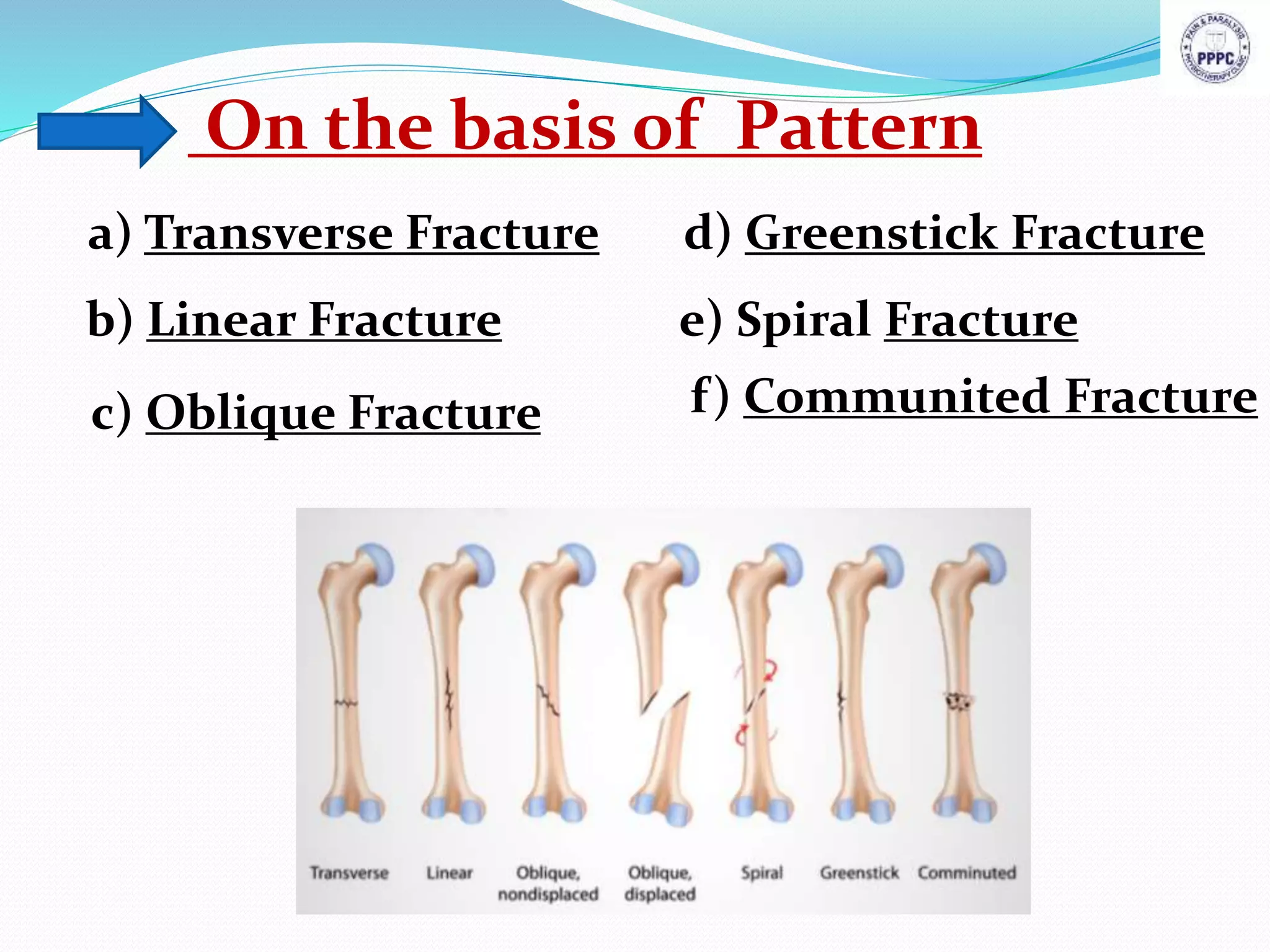 Fractures healing complication & management | PPTX
