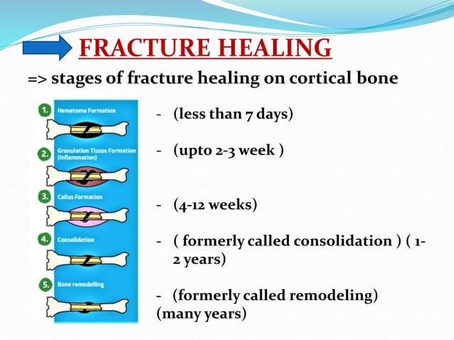 Fractures healing complication & management | PPTX