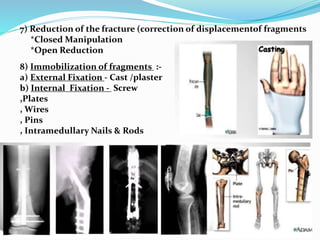 Fractures healing complication & management | PPTX | Death, Injury, or ...