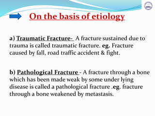 Fractures healing complication & management | PPTX