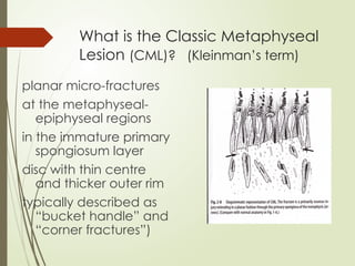 Fractures in Children Mechanisms and Estimations.pptx