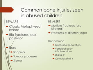 Fractures in Children Mechanisms and Estimations.pptx