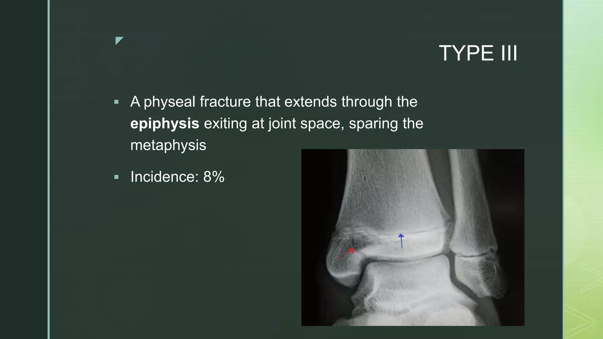 Fractures in Paediatric Age Group.pptx
