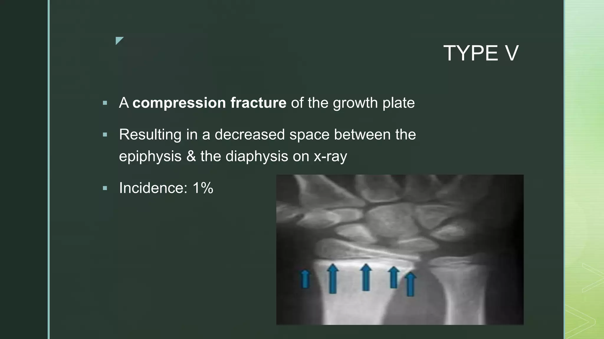 Fractures in Paediatric Age Group.pptx
