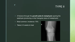 Fractures in Paediatric Age Group.pptx
