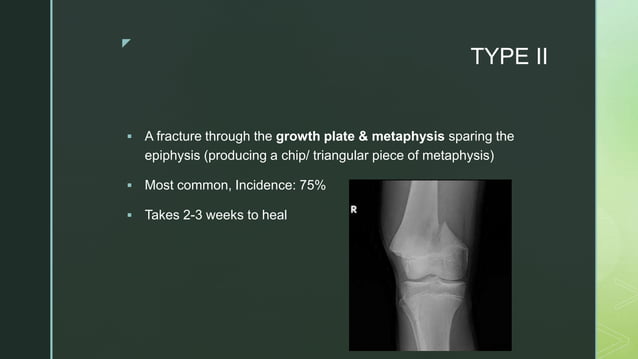 Fractures in Paediatric Age Group.pptx