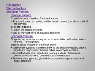 FRACTURE (Sites) | PPTX