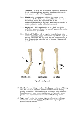 fractures_long_bones_upper_limb.pdf