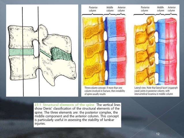 fractures of cervical spine and applied anatomy revised.pptx