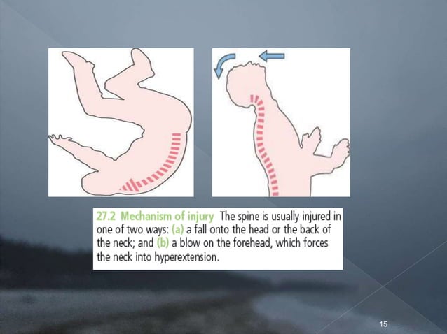 fractures of cervical spine and applied anatomy revised.pptx