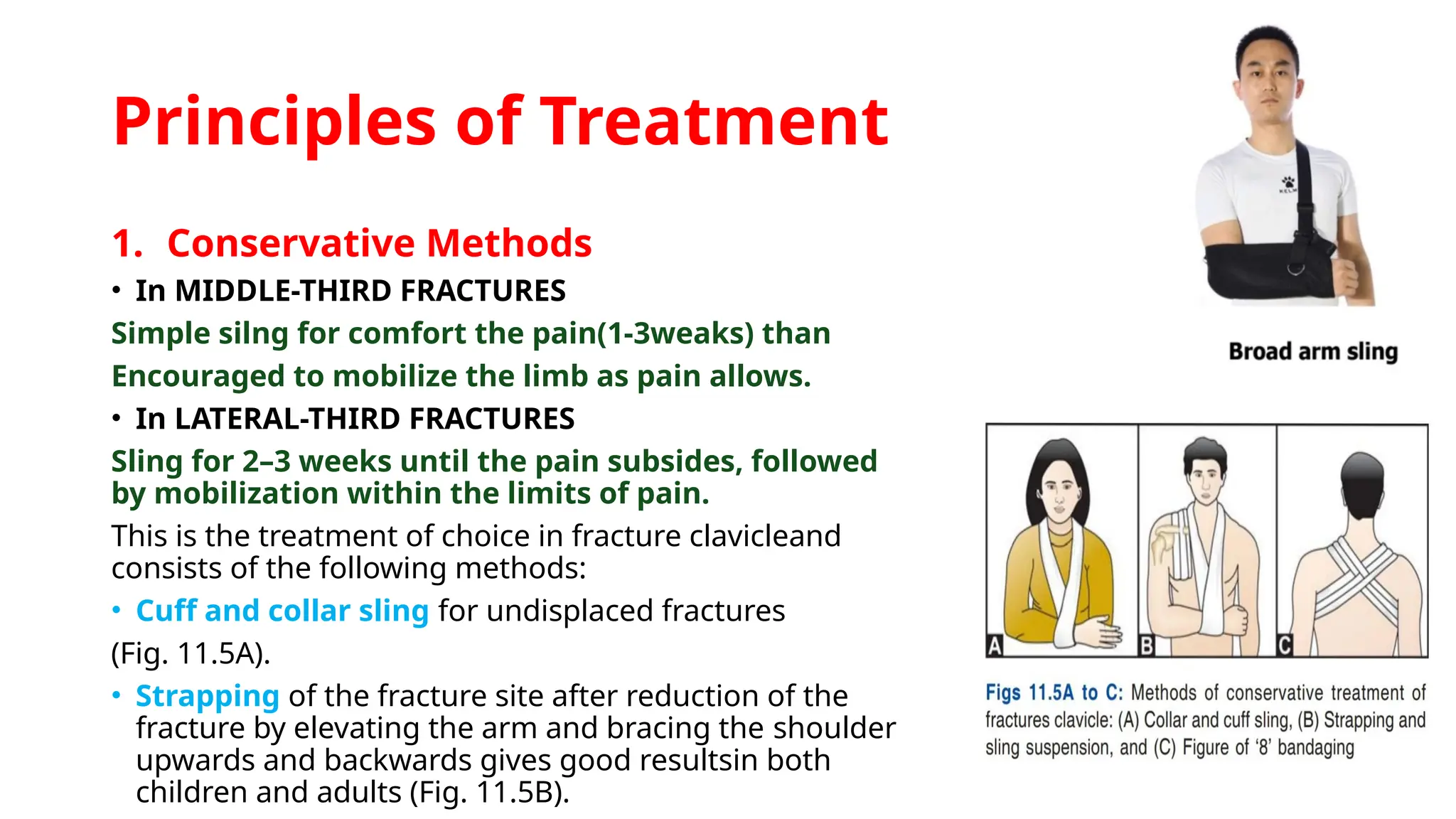 The Fractures of clavicle & scapula.pptx