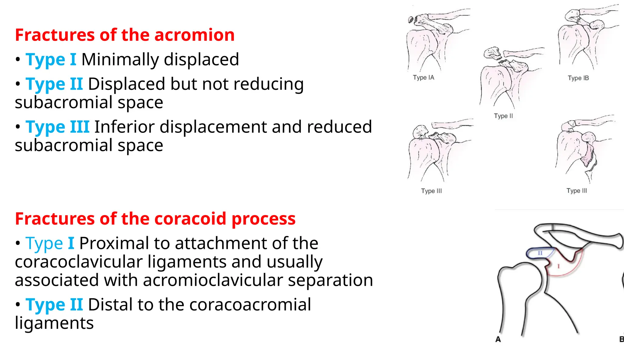 The Fractures of clavicle & scapula.pptx