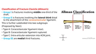 The Fractures of clavicle & scapula.pptx