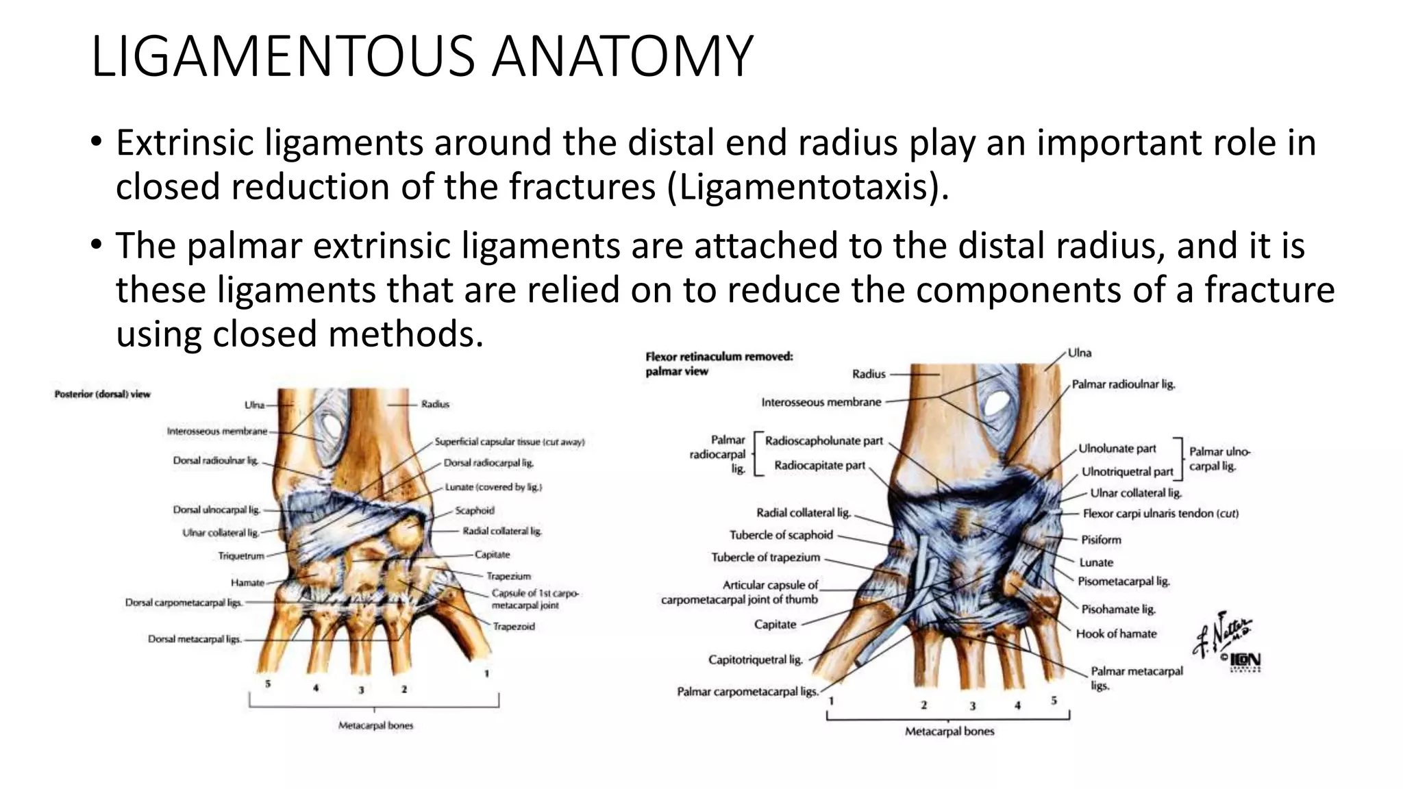 Fractures of distal end radius | PPTX