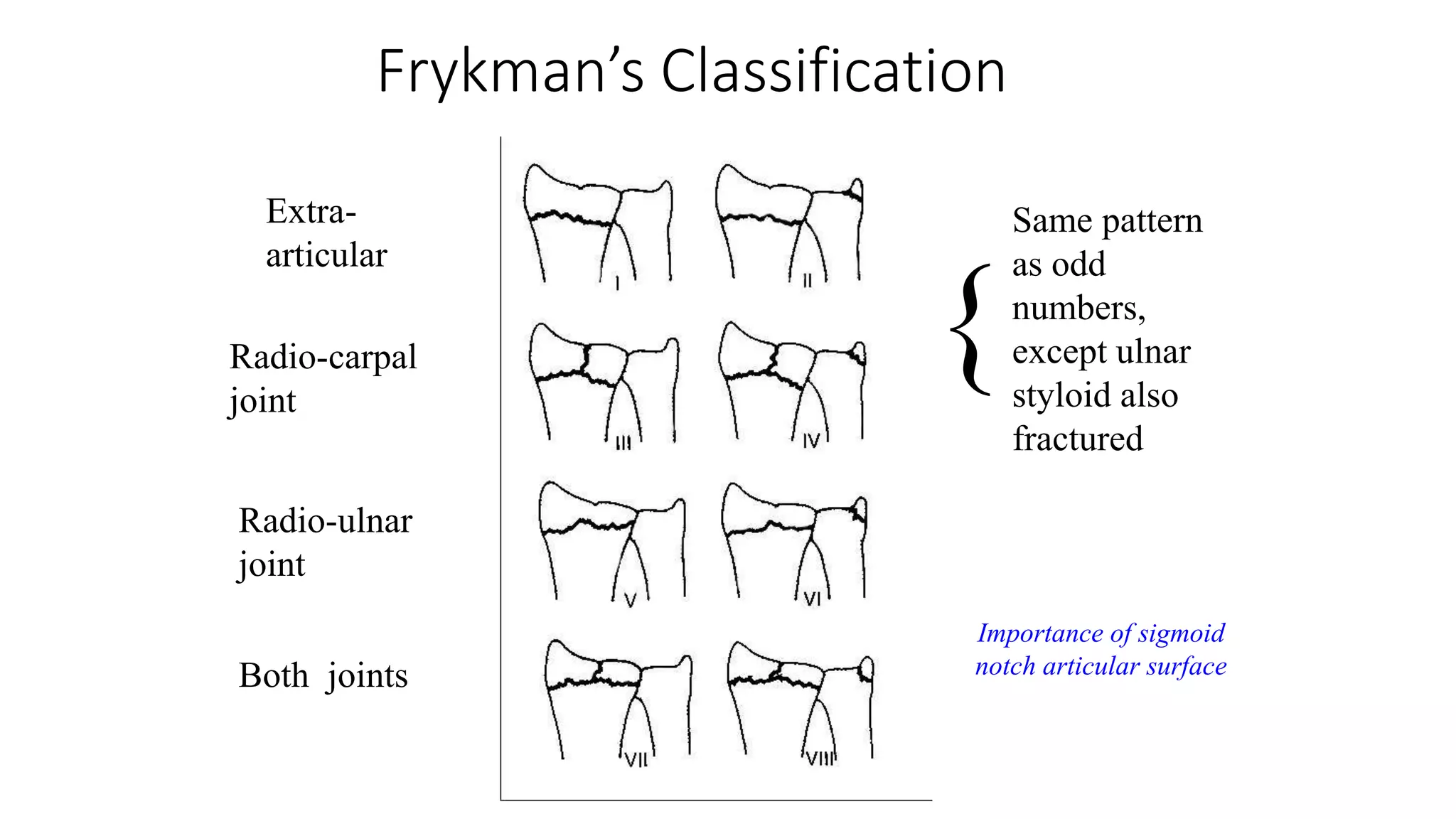 Fractures of distal end radius | PPTX