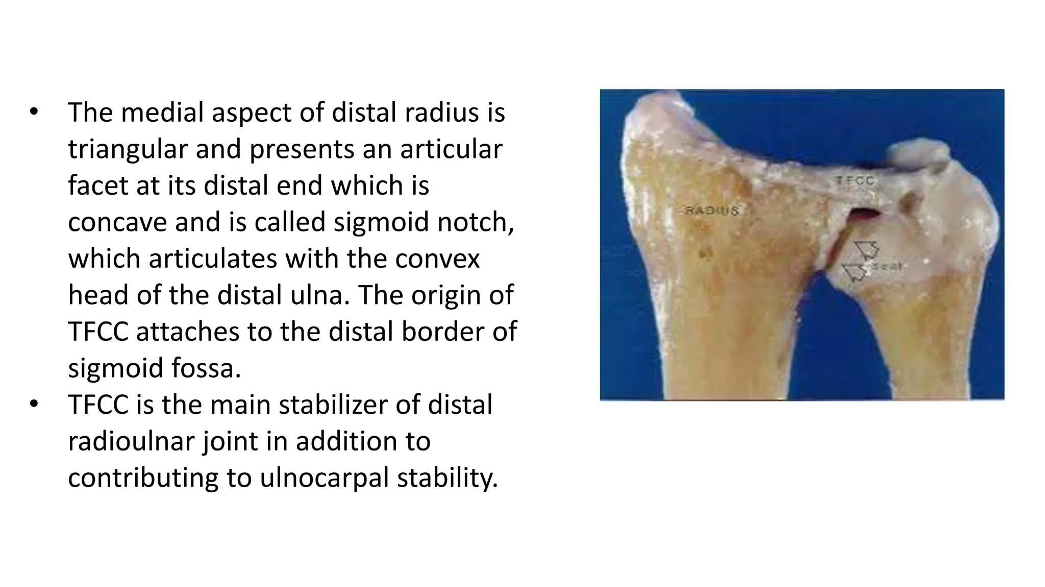 Fractures of distal end radius | PPTX