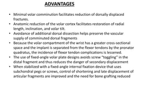 Fractures of distal end radius | PPTX